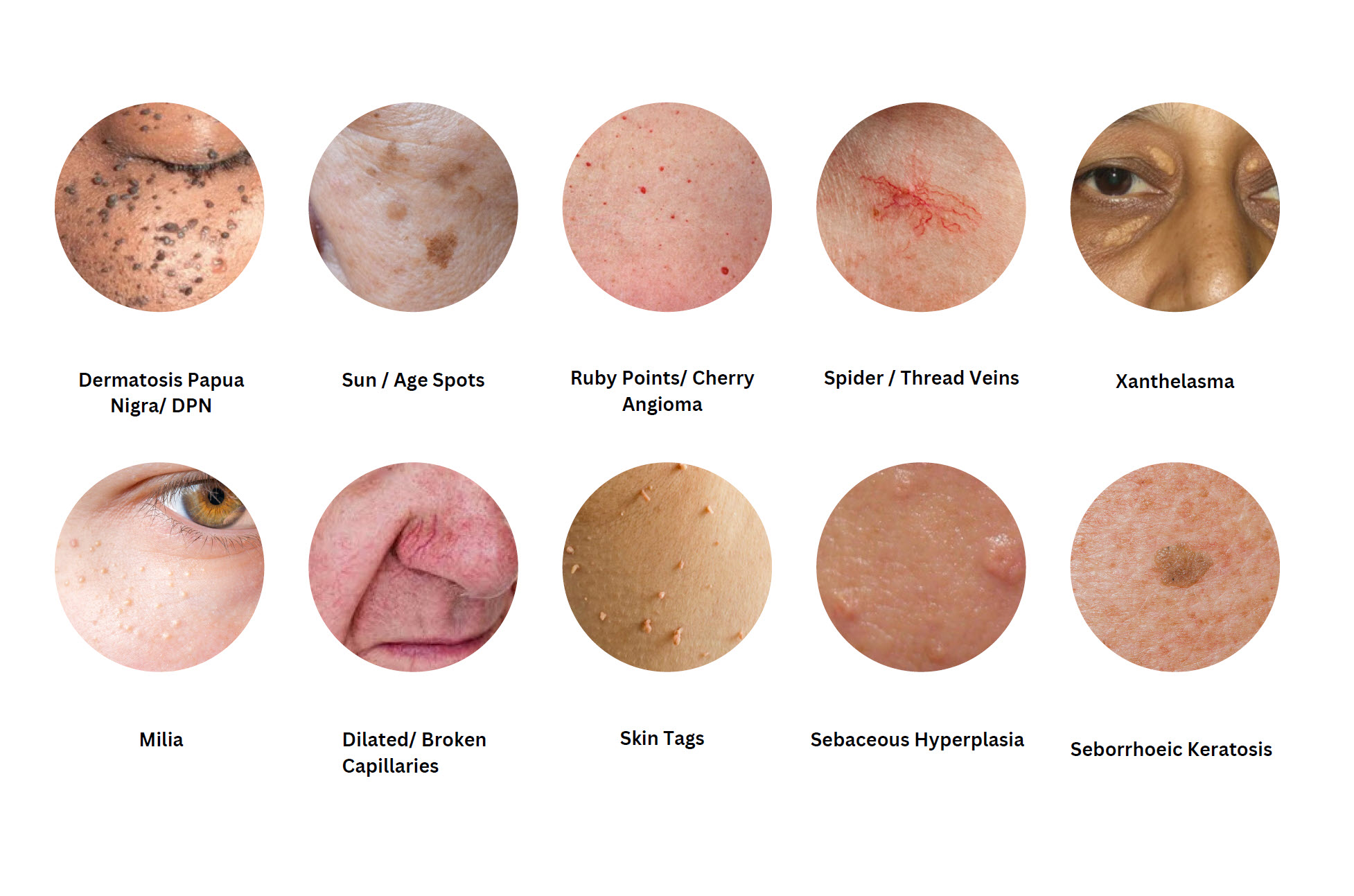 Blemish Removal – Emoveo